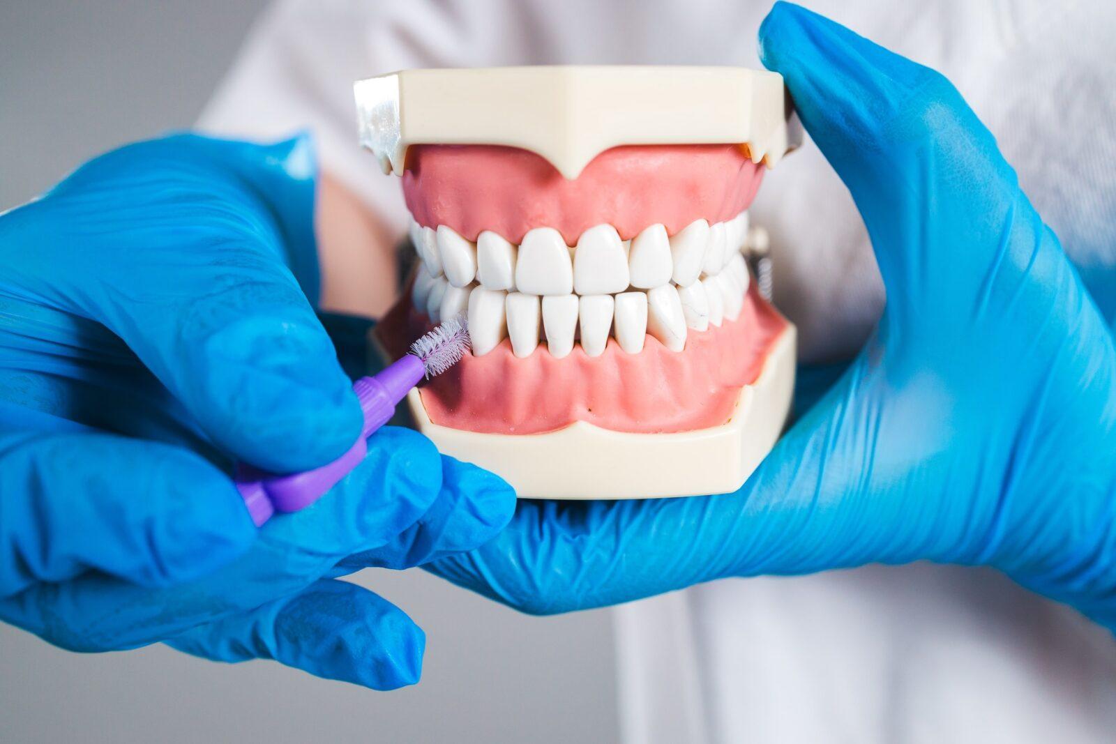 Cleaning Between Teeth - Blythe Road Dental Practice